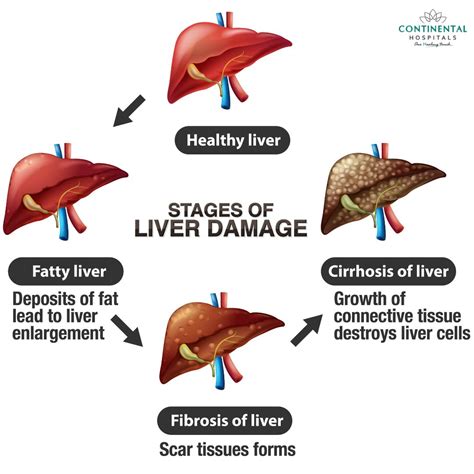 Liver Disease Symptoms