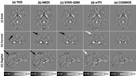 Comparison Of Qsm Of A Multi Orientation Dataset Download Scientific