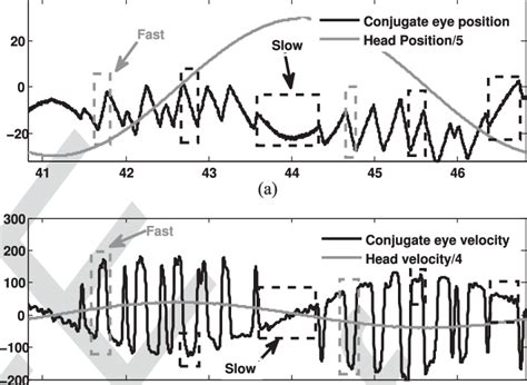 Vor In Response To Sinusoidal Head Rotation Recorded With Eog A