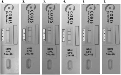 Multiplex Lateral Flow Immunochromatographic Assay For The Detection Of