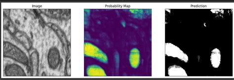 jaykumaran r on linkedin sam segmentation on mitochondria finetuning