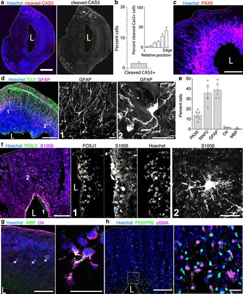 Diversity Of Neural Cells Including Outer Radial Glia Astrocytes And Download Scientific