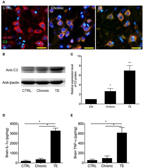 Identification Of A1 Astrocyte Gfap⁺c3⁺ In The Brain Of Mice With