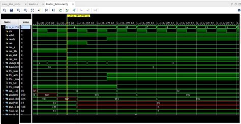 Figure 6 From Design Of An Ip Core For Motion Blur Detection In Fundus Images Using An Fpga