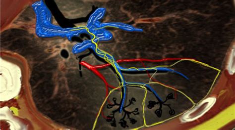 The Radiology Assistant Home