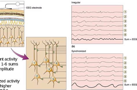 EEG Lab Quiz Flashcards Quizlet