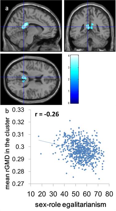 Anatomical Correlates Of Sre A The Region Showing Significant