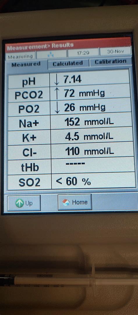Abg On My Last Vent Case On Arrival R Vettech