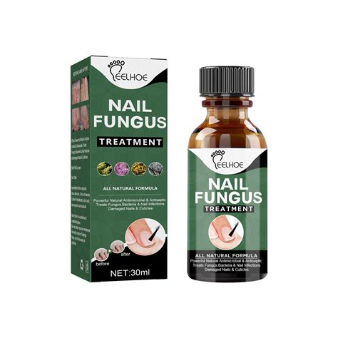 Eelhoe Nail Fungus Treatment Serum Paronychia Onychomycosis Nail Foot