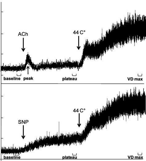 Examples Of Laser Doppler Flow [ldf In Arbitrary Units Au ] Download Scientific Diagram