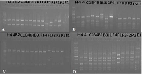 Rflp Analysis Of Bacterial Isolates By Different Restriction Enzymes Download Scientific