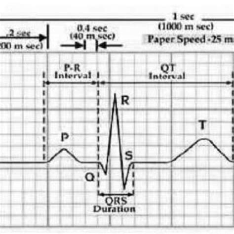 Normal Ecg Beats And Intervals 22 Discrete Fourier Transform Dft The