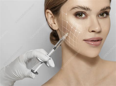 Cosmetic Injection Stock Image F0365929 Science Photo Library