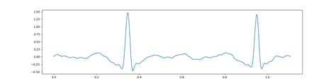 Ecg Data Compressive Sensing — Cr Sparse Documentation