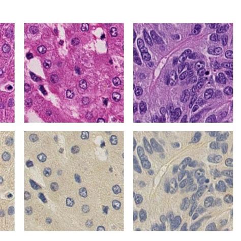 Ihc To Hande Examples Fig 8 Color Deconvolution Examples Download