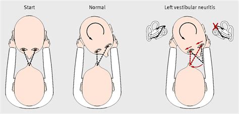 Heads Up Test Stroke At Claire Haswell Blog
