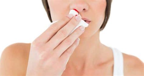 Suffering From A Nosebleed Here Are 10 Things That Could Be Causing It