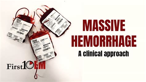 Massive Hemorrhage The Clinical Approach First10em