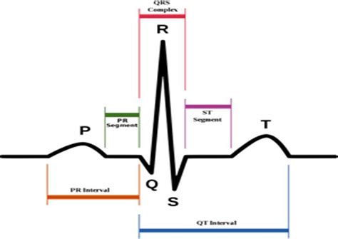 low cost ecg analyzing system by ijraset issuu