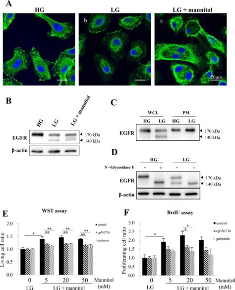 Nfat5 Promotes Oral Squamous Cell Carcinoma Progression In A