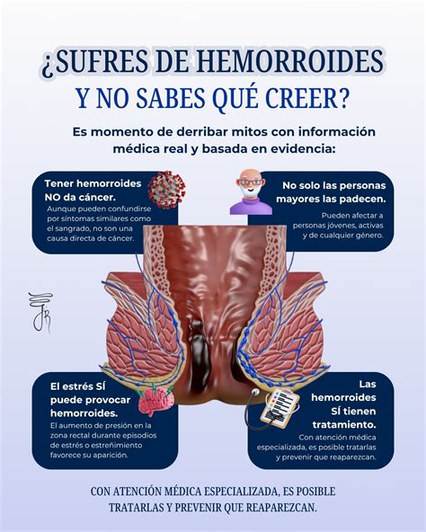 Sintomas De Hemorroides Internas Inflamadas