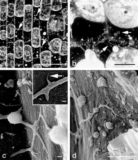 A D Cellulase Treatment Of Plasmolysed Cells Clsm And Fesem A Small Download Scientific