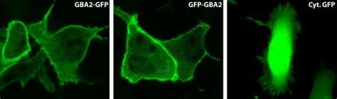 Subcellular Localization Of Gba2 Gfp Or Gfp Gba2 Fusion Proteins