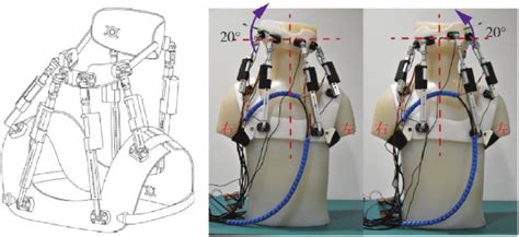 6 sps cs parallel manipulator cervical exoskeleton [86] download