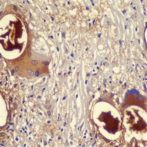 B Fite Faraco Staining Positivity In The Contents Of A Vacuole Of A Download Scientific