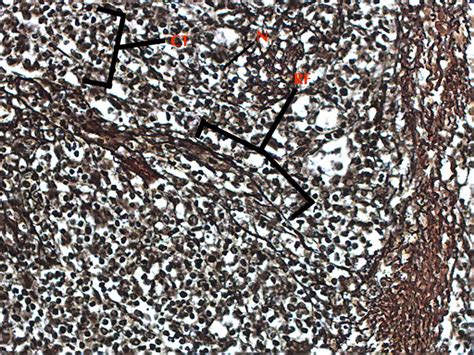 Reticular Connective Tissue 20x Histology