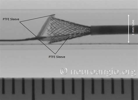 Pipeline Flex Pipeline Flex