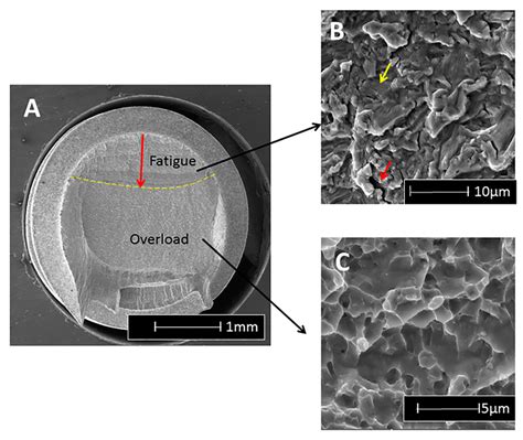 Intaglio Surface Dentistry Bastahack
