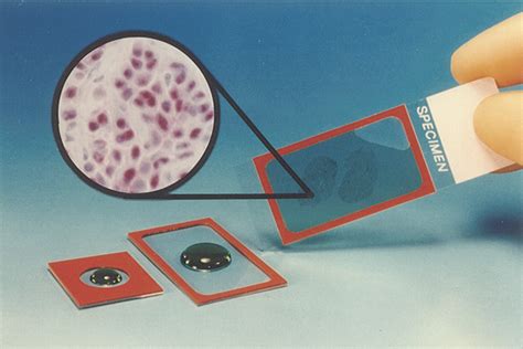 Coverwell™ Incubation Chambers