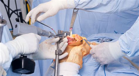 Preguntas De Cirugia Docsity Diagnosticos De Enfermer - vrogue.co