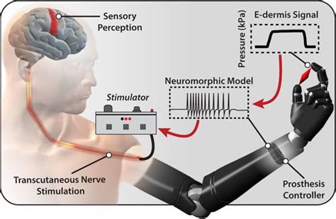 Prosthesis System Diagram Download Scientific Diagram