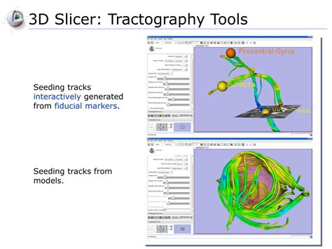 ppt 3d slicer a free and open source platform for medical image