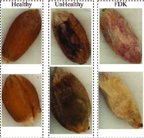 Examples Of Single Kernel Images For Each Kernel Damage Category That Download Scientific