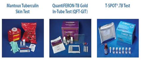 Quantiferon In The Diagnosis Of Tuberculosis Auctores