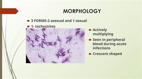 Toxoplasma Encephalitis Pptx A Ppt On Toxoplasma Encephalitis A Topic Of Microbiology Ppt