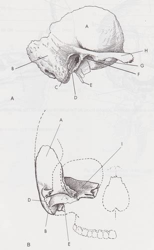 Skull Bones Temporal Bone Flashcards Quizlet