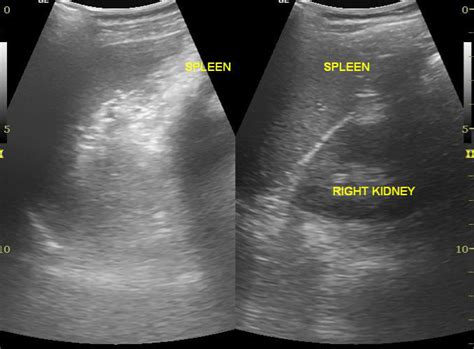 Situs Inversus Image