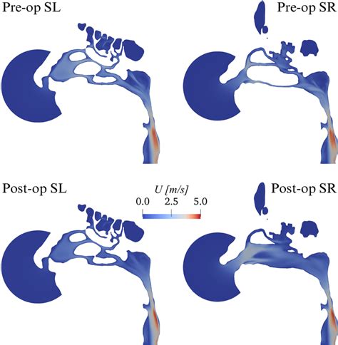 cfr comparison magnitude u of the mean velocity vector in planes sl