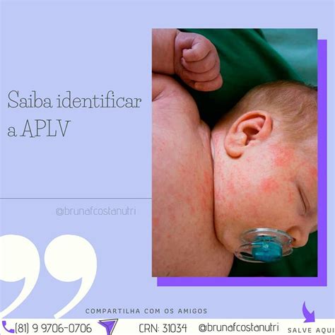 Saiba Como Identificar A Aplv Aplv Alergiaalimentar Leitedevaca