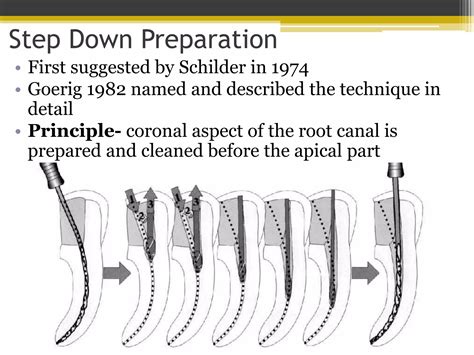 Cleaning And Shaping Of Root Canal Systems Pptx