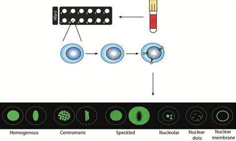 Principles And Staining Patterns Of Indirect Immunofluorescence Download Scientific Diagram