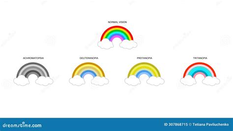 Color Blindness Poster Cartoon Vector 306195563