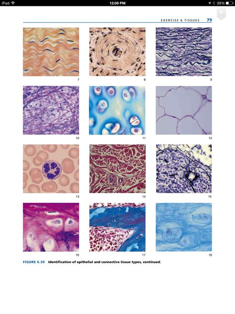 Classification Of Connective Tissue