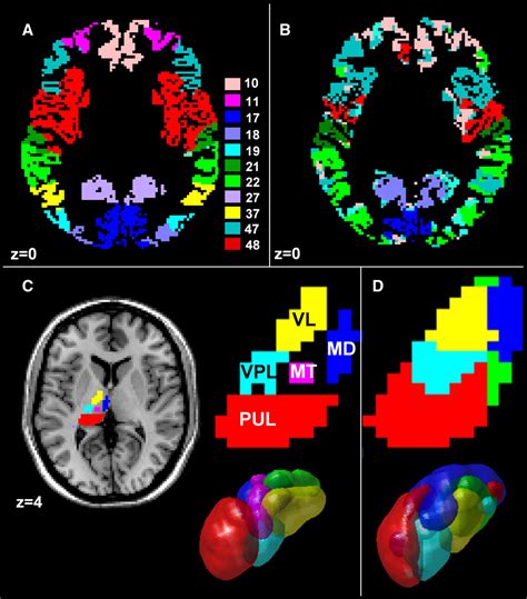 Figure 2 From Cluster Analysis Of Resting State Fmri Time Series Semantic Scholar