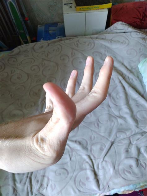 My Hands Can Do This And It S Actually A Neat Party Trick If You Use It Correctly Scrolller