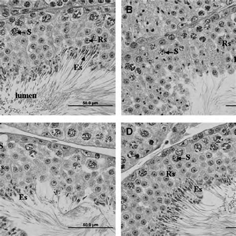 Testis Histology Of And Ϫ Ϫ Male Mice Fed Ain93g Diet With Or